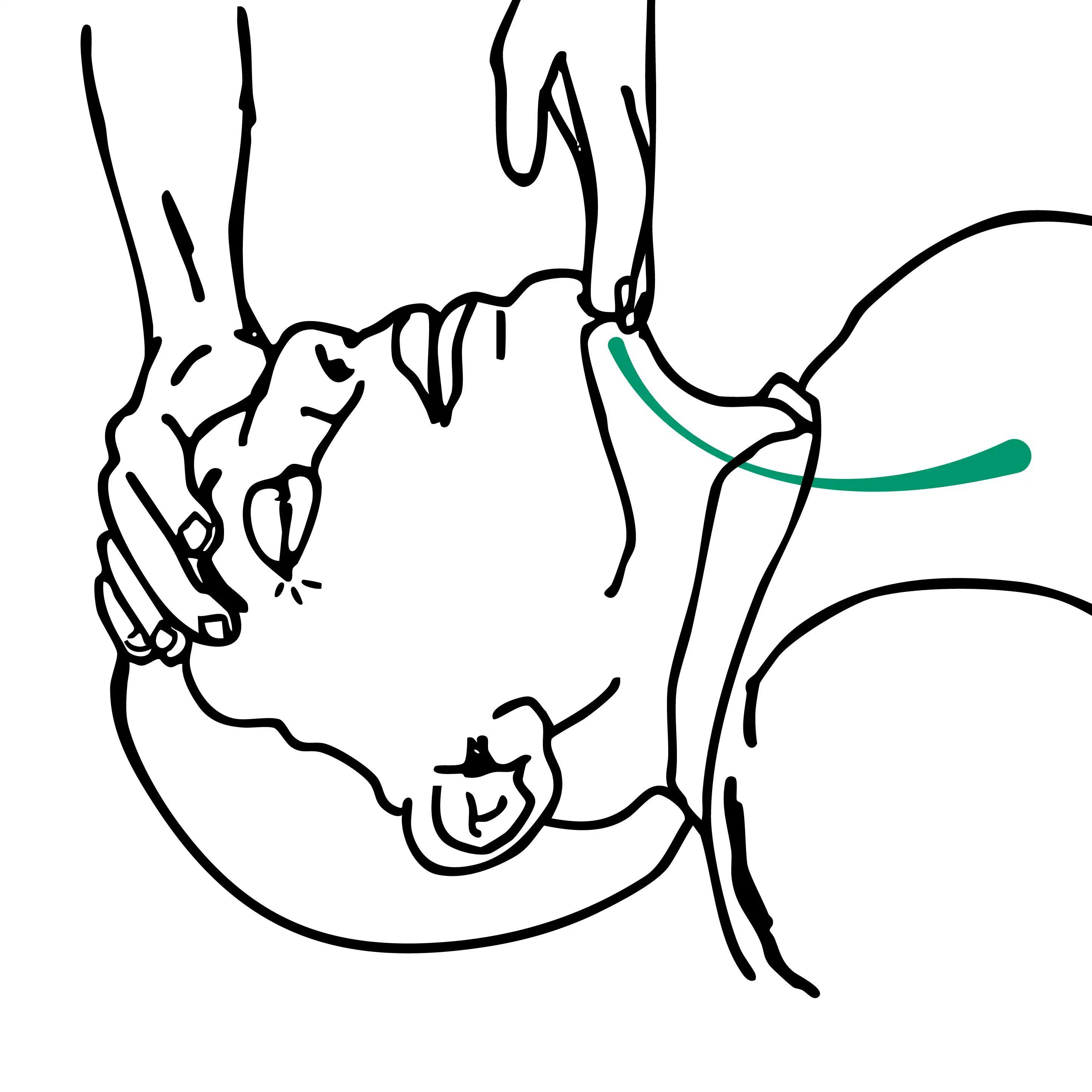 Das cABCDE-Schema schnell verstehen und anwenden