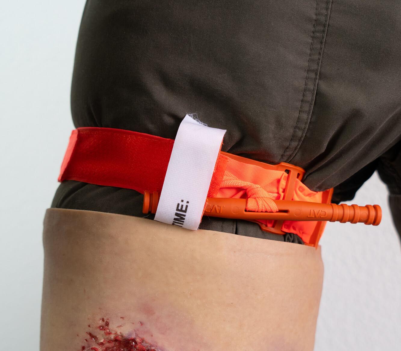 Die 10 häufigsten Fehler bei der Anwendung von Tourniquets